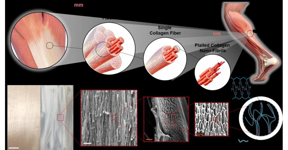 Artificial Tendons and Ligaments Market Expected to Expand at a Steady ...